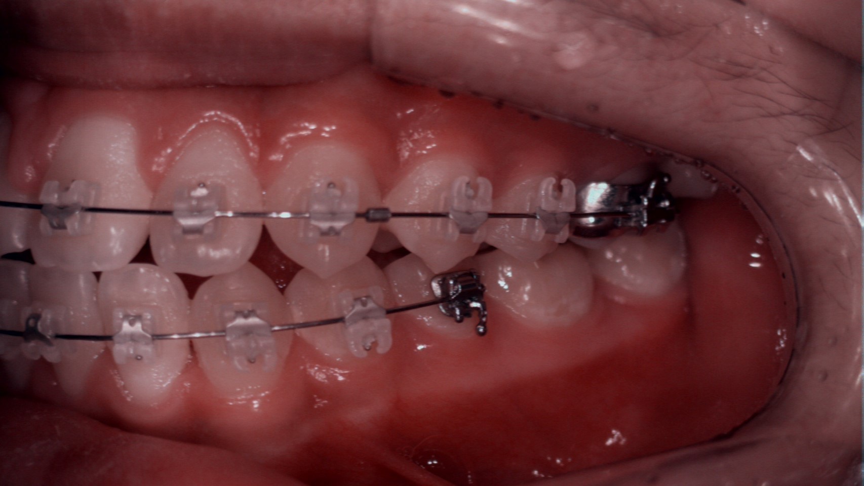 AIOBIO Co., Ltd. : Clinic Case - Qray로 진단하고! LinkDens로 관리하자!!