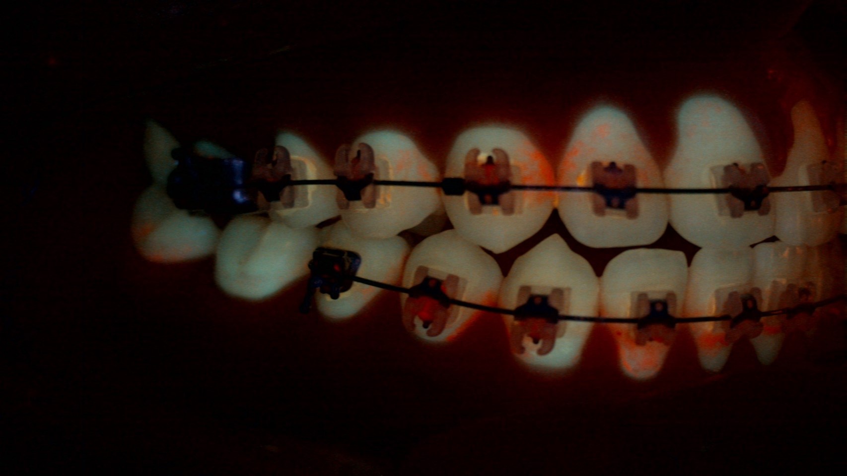 AIOBIO Co., Ltd. : Clinic Case - Qray로 진단하고! LinkDens로 관리하자!!