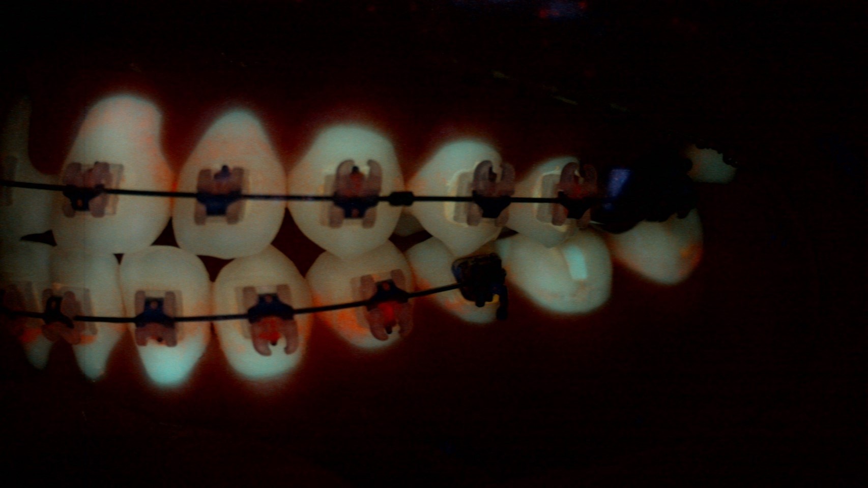 AIOBIO Co., Ltd. : Clinic Case - Qray로 진단하고! LinkDens로 관리하자!!