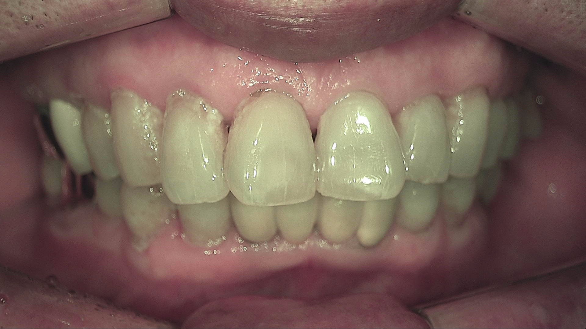 AIOBIO Co., Ltd. : Qray m - Revolutionizing Dental Care with Biofluorescence-Led Intelligent ...