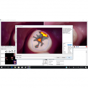 AIOBIO Co., Ltd. : Qray Products - Revolutionizing Dental Care with Biofluorescence-Led ...