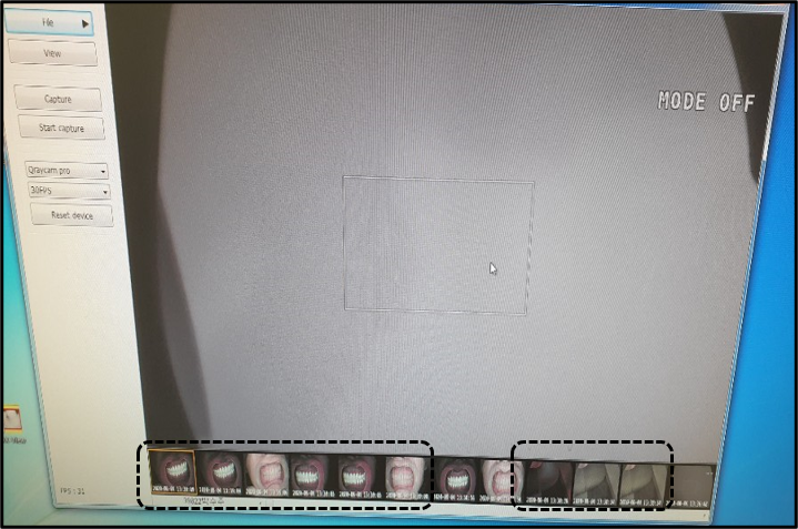 AIOBIO Co., Ltd. : Qraycam Pro - Revolutionizing Dental Care with BLISS™ – a Biofluorescence-Led ...